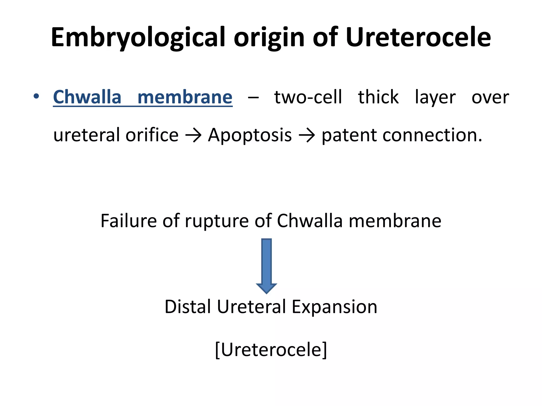 Ectopic ureter and ureterocele - Embryology and Presentation | PPTX
