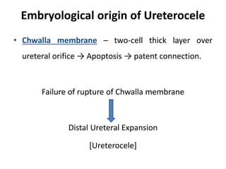 Ectopic ureter and ureterocele - Embryology and Presentation | PPTX