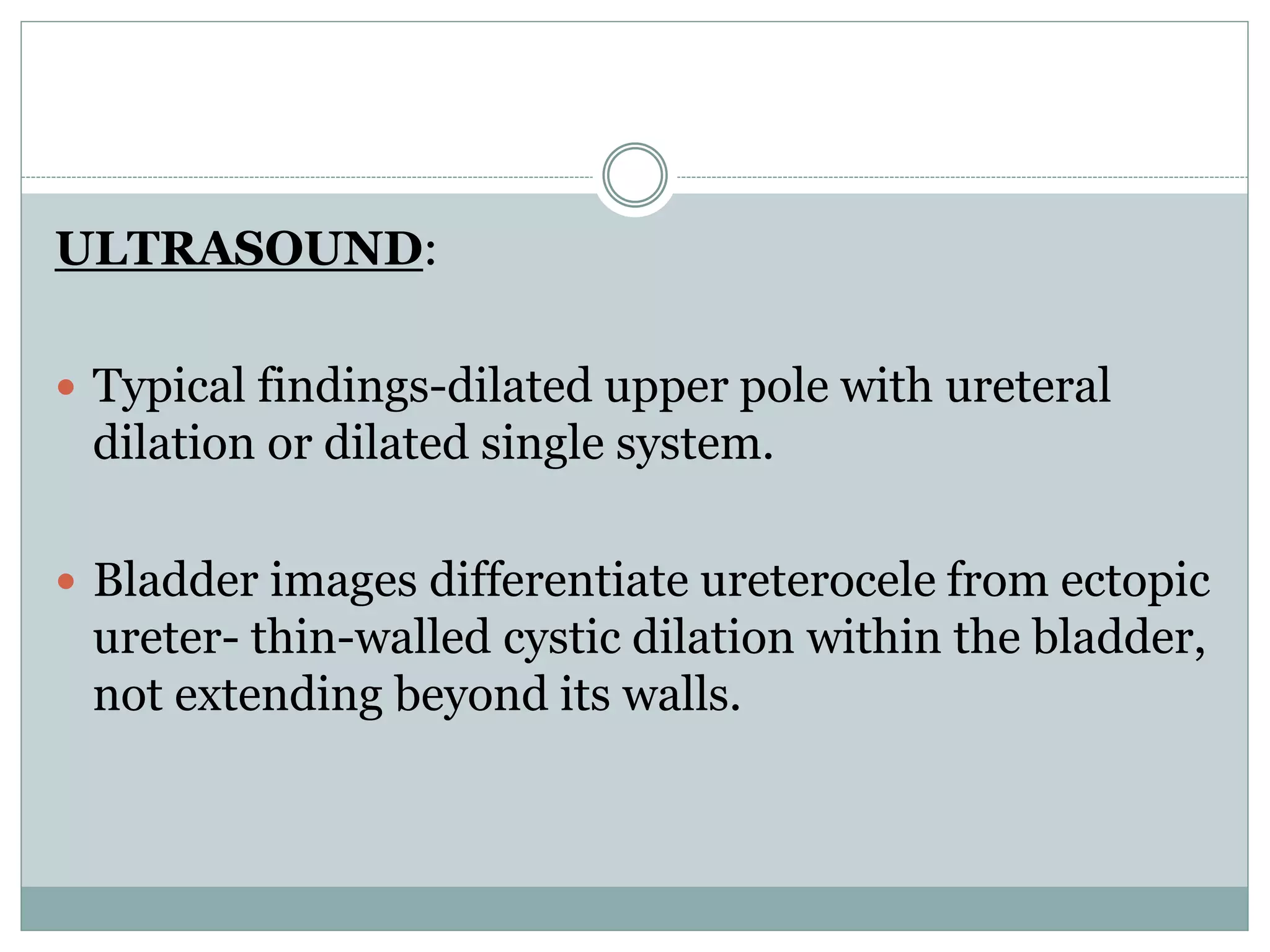 Ectopic ureter & ureterocoele | PPTX