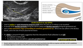 ectopic pregnancy Ultrasound Daignosis.pdf
