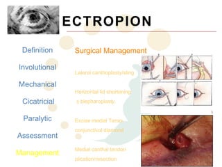 Ectropion | PPT