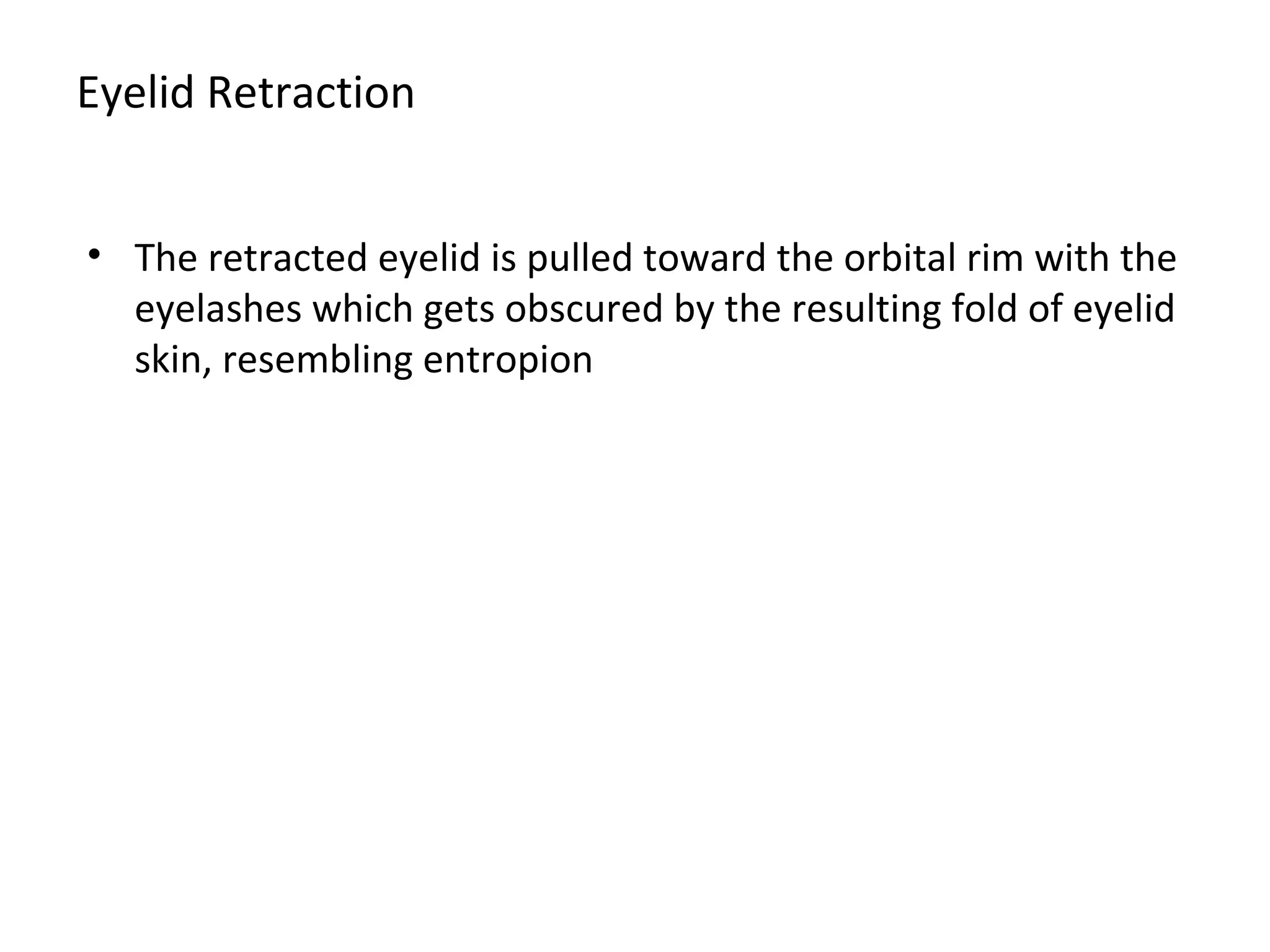 Entropion and its surgical correction | PPT