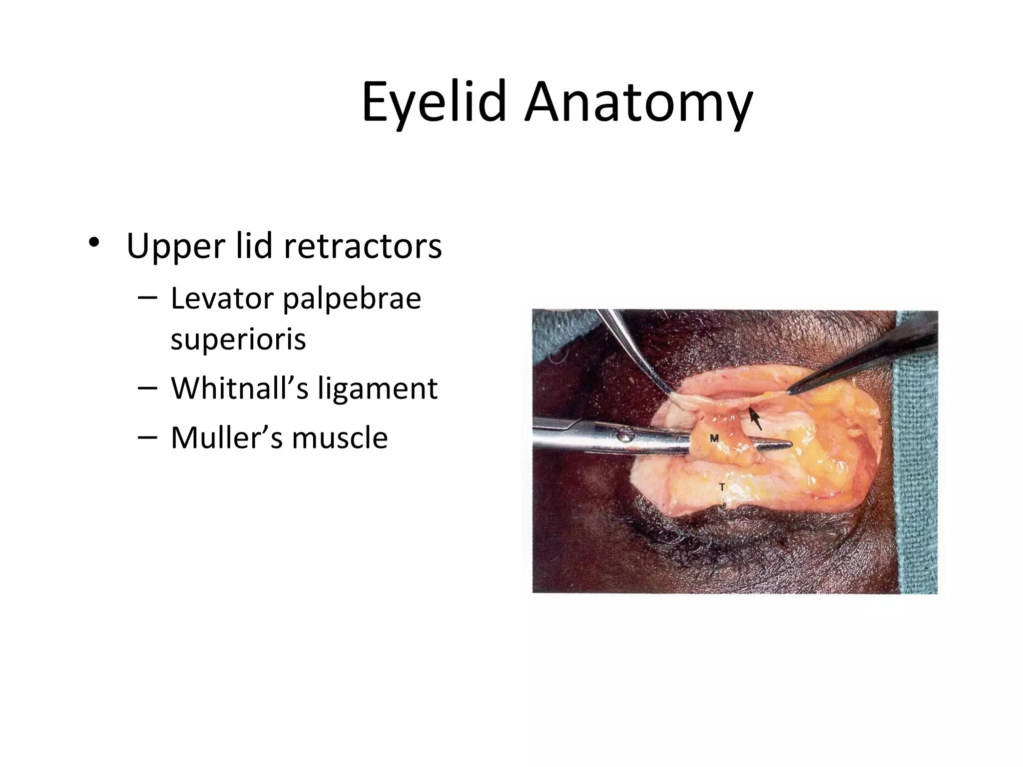 Entropion and its surgical correction | PPT