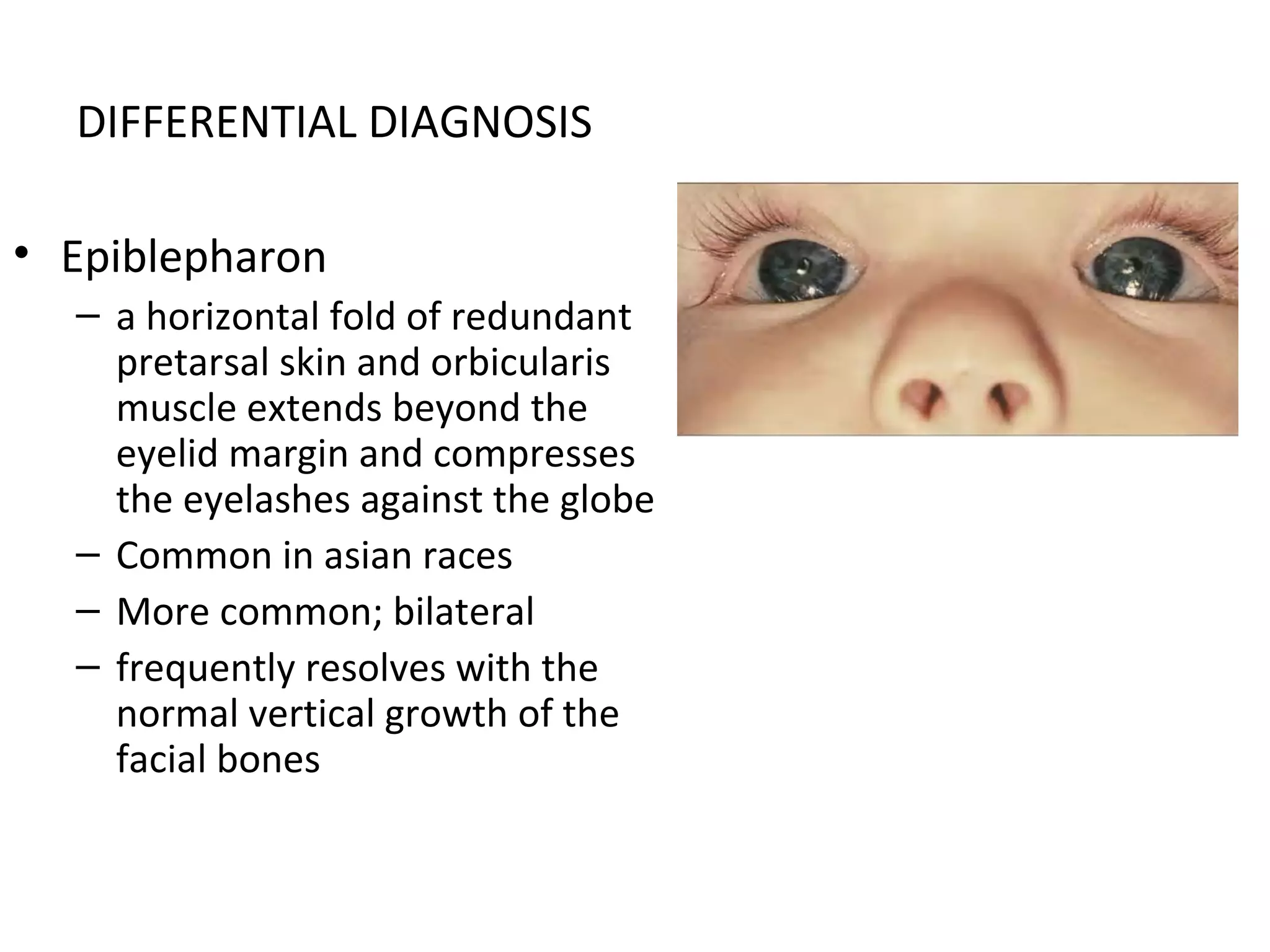 Entropion and its surgical correction | PPT