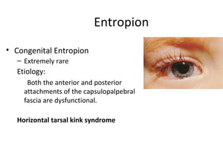 Entropion and its surgical correction | PPT