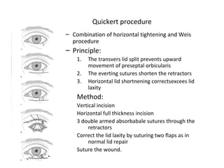 Entropion and its surgical correction | PPT