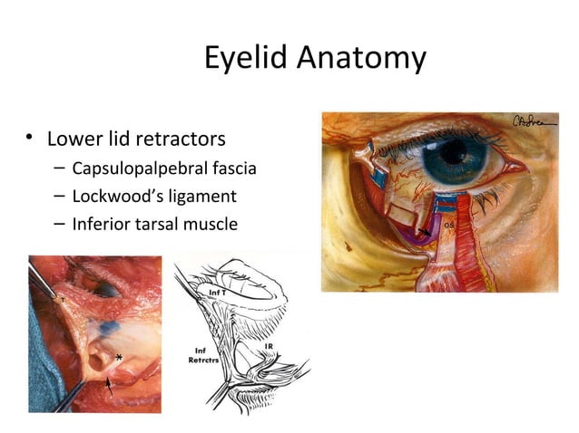 Entropion and its surgical correction | PPT