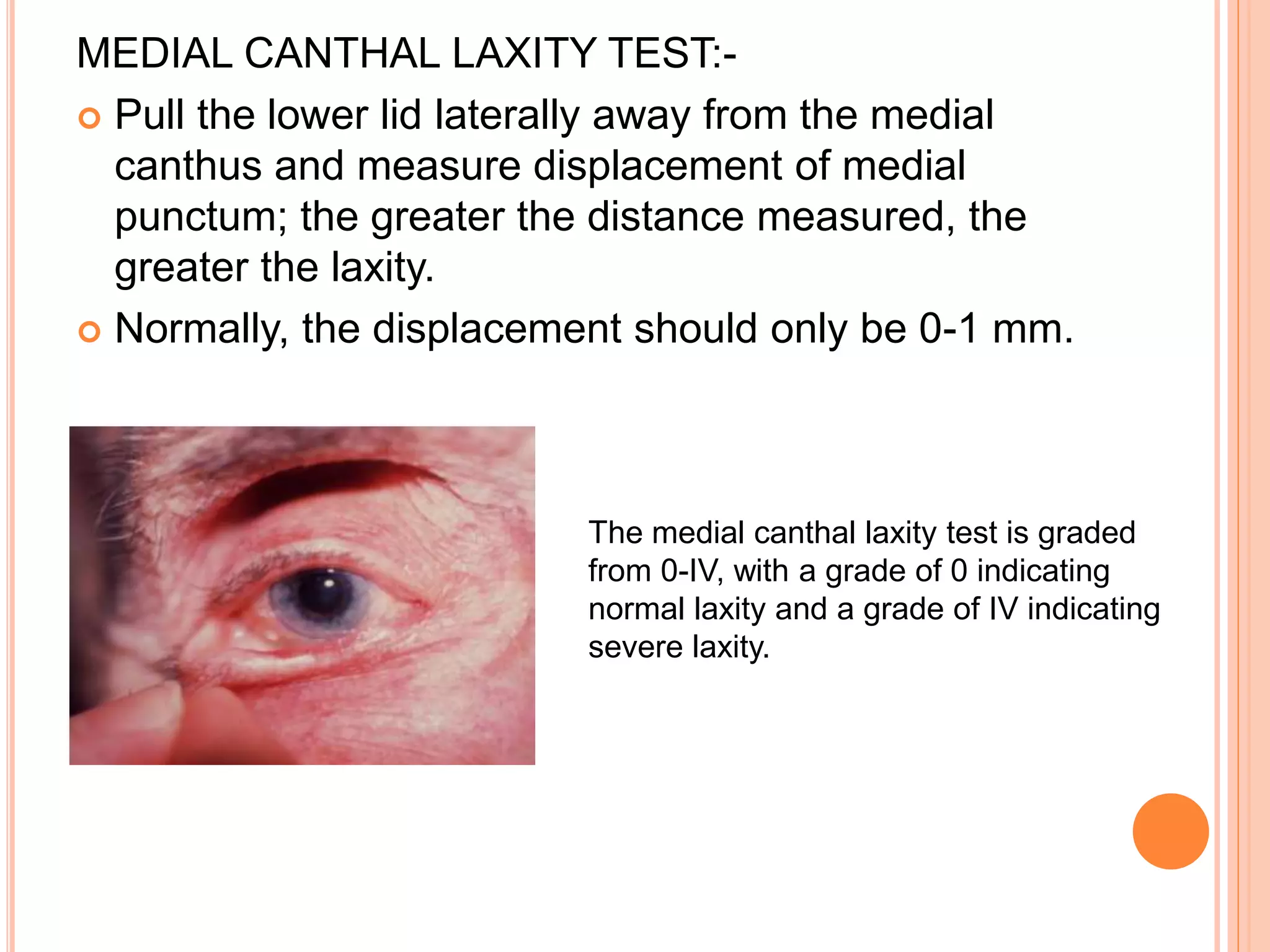 Ectropion and entropion | PPTX