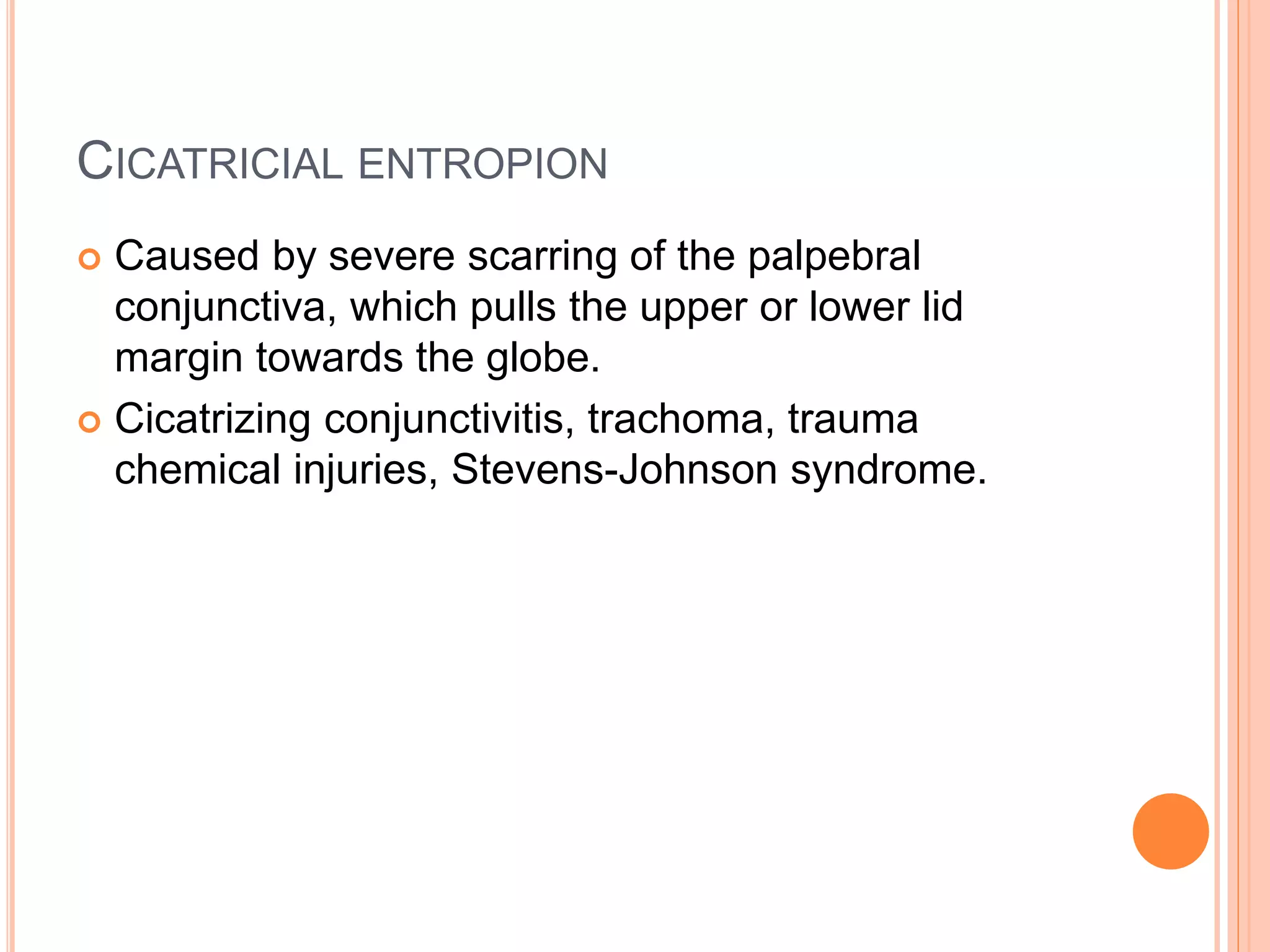 Ectropion and entropion | PPTX