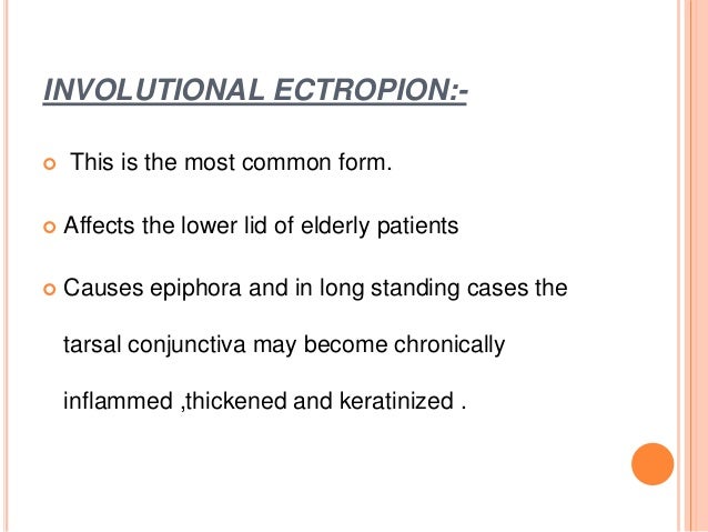 Eyelid Ectropion And Entropion Causes Symptoms And Eyelashes & Eyelid