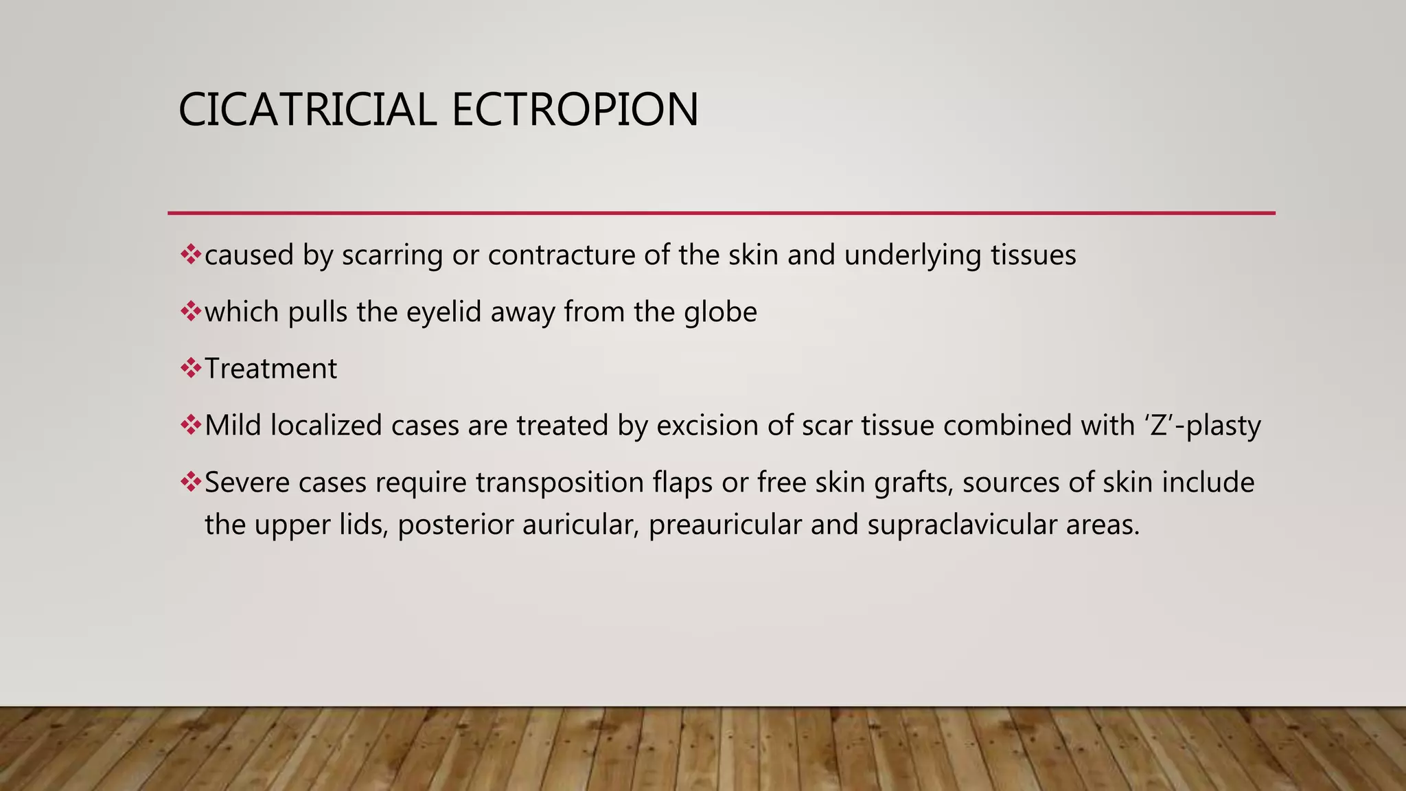Ectropion | PPTX