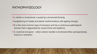 Ectropion | PPTX