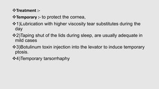 Ectropion | PPTX