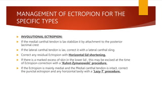 ECTROPION^JENTROPION AND THEIR MANAGEMENT 2.pptx