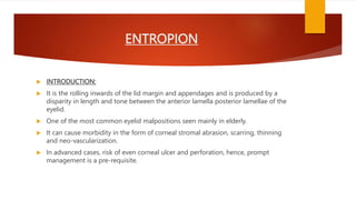 ECTROPION^JENTROPION AND THEIR MANAGEMENT 2.pptx