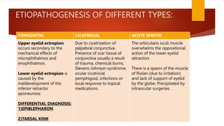 ECTROPION^JENTROPION AND THEIR MANAGEMENT 2.pptx