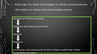 Ectropion | PPTX