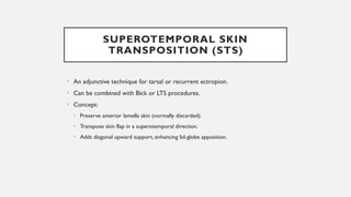 Ectropion Repair Techniques in lower eyelid.pptx
