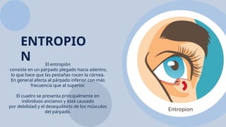 entropion y ectropion en oftalmologia y cpo | PPTX