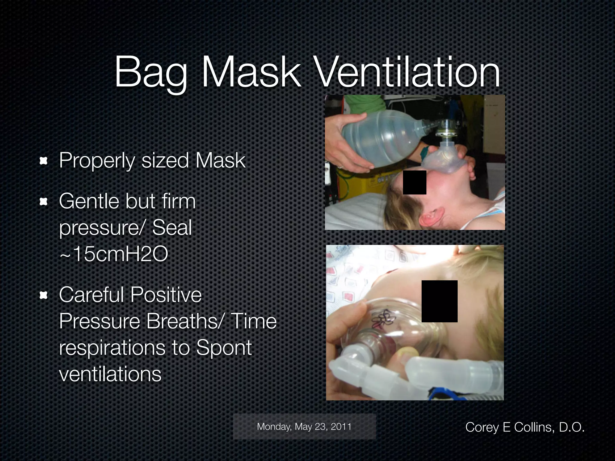 Basics of Pediatric Airway Management | PPT