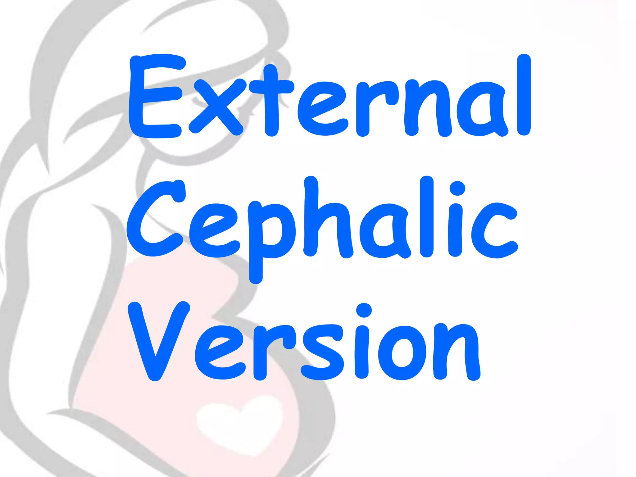 Ecv- External Cephalic Version- Define, Risk, procedure, step, benefits ...