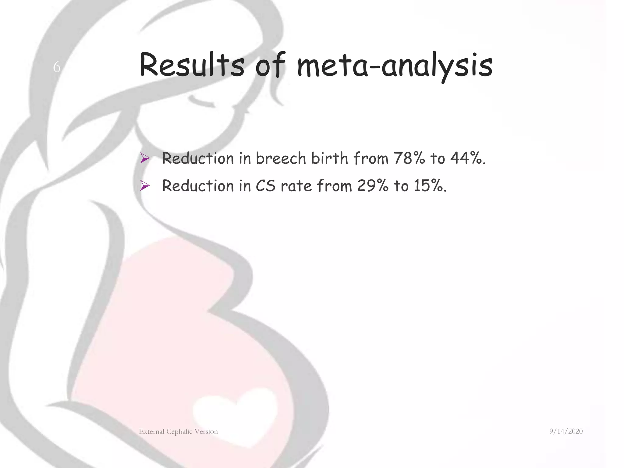 Ecv- External Cephalic Version- Define, Risk, procedure, step, benefits ...