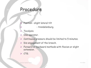 Ecv- External Cephalic Version- Define, Risk, procedure, step, benefits ...