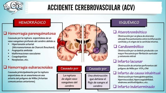 ECV Isquemico. Dr Victor Raudales. Médico Internista