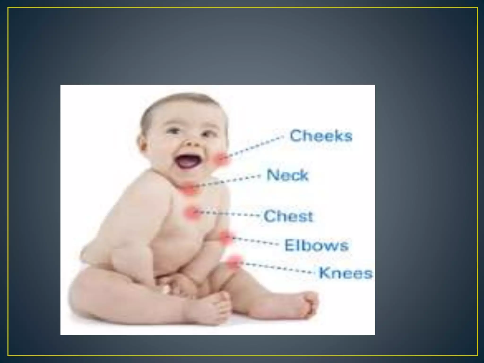 Eczema | PPTX | Skin and Dermatology | Diseases and Conditions