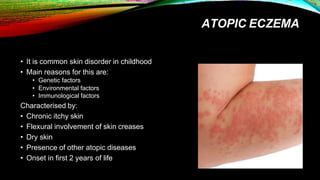 eczema complete information including treatment | PPTX