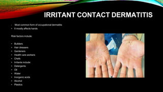 eczema complete information including treatment | PPTX