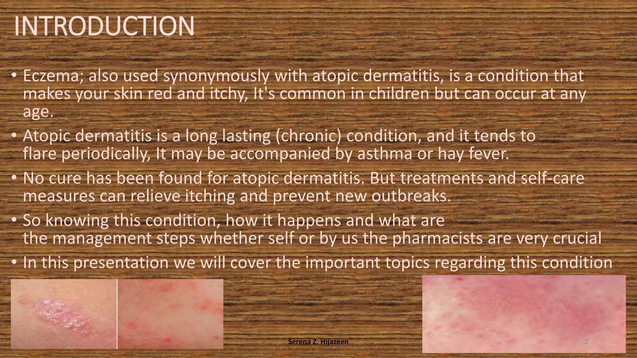 Eczema (Atopic Dermatitis) Definition, clinical presentation, and ...