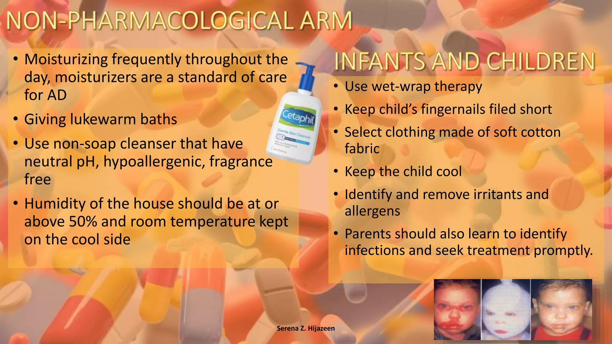 Eczema Atopic Dermatitis Definition Clinical Presentation And Management Ppt