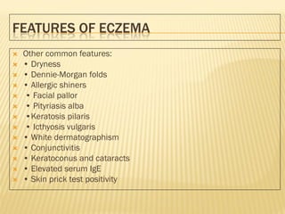 Eczema | PDF