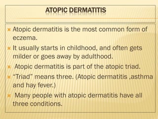 Eczema | PDF