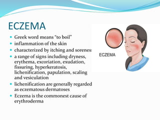 Eczema | PPTX