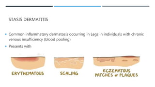 Eczema/ Dermatitis | PPT