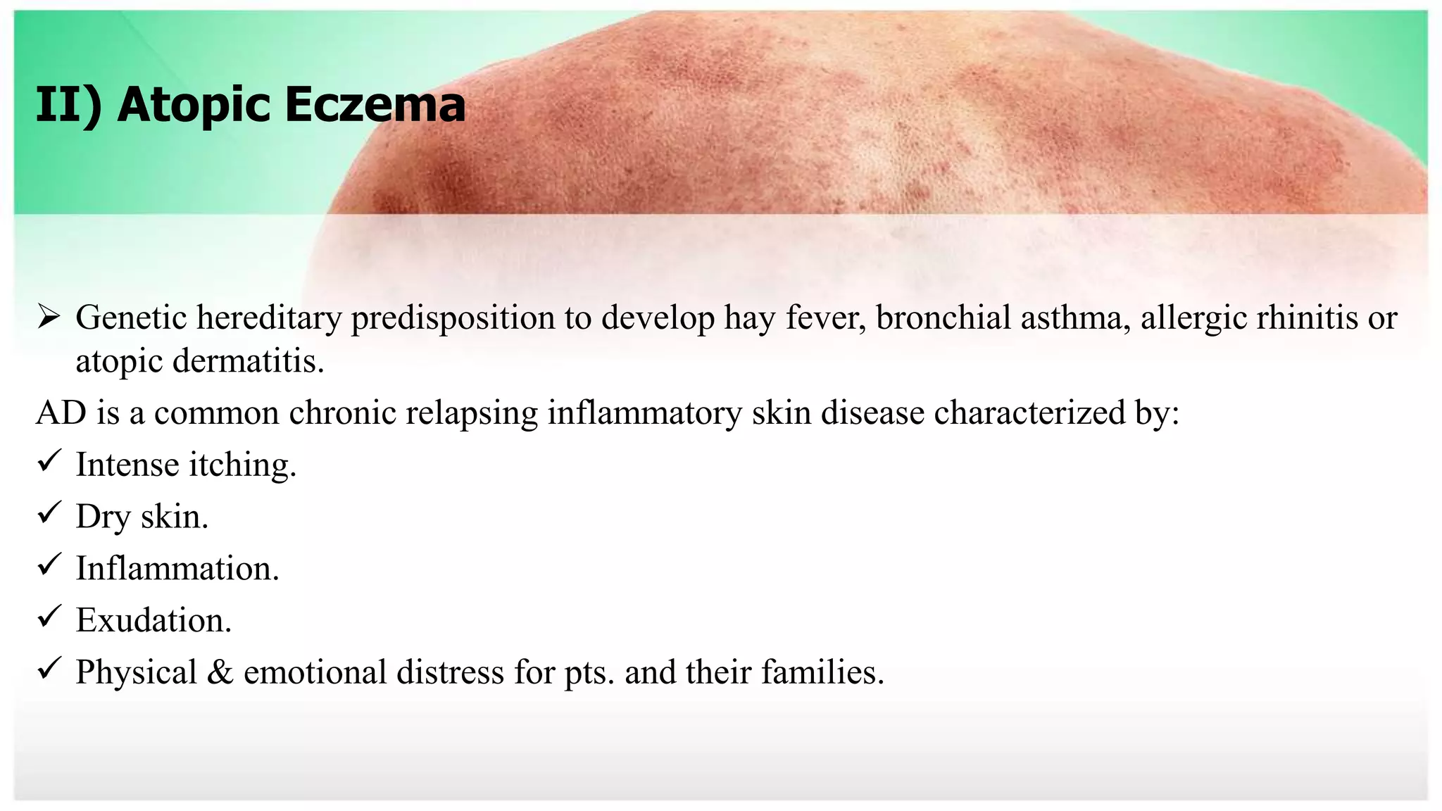 ECZEMA.pptx