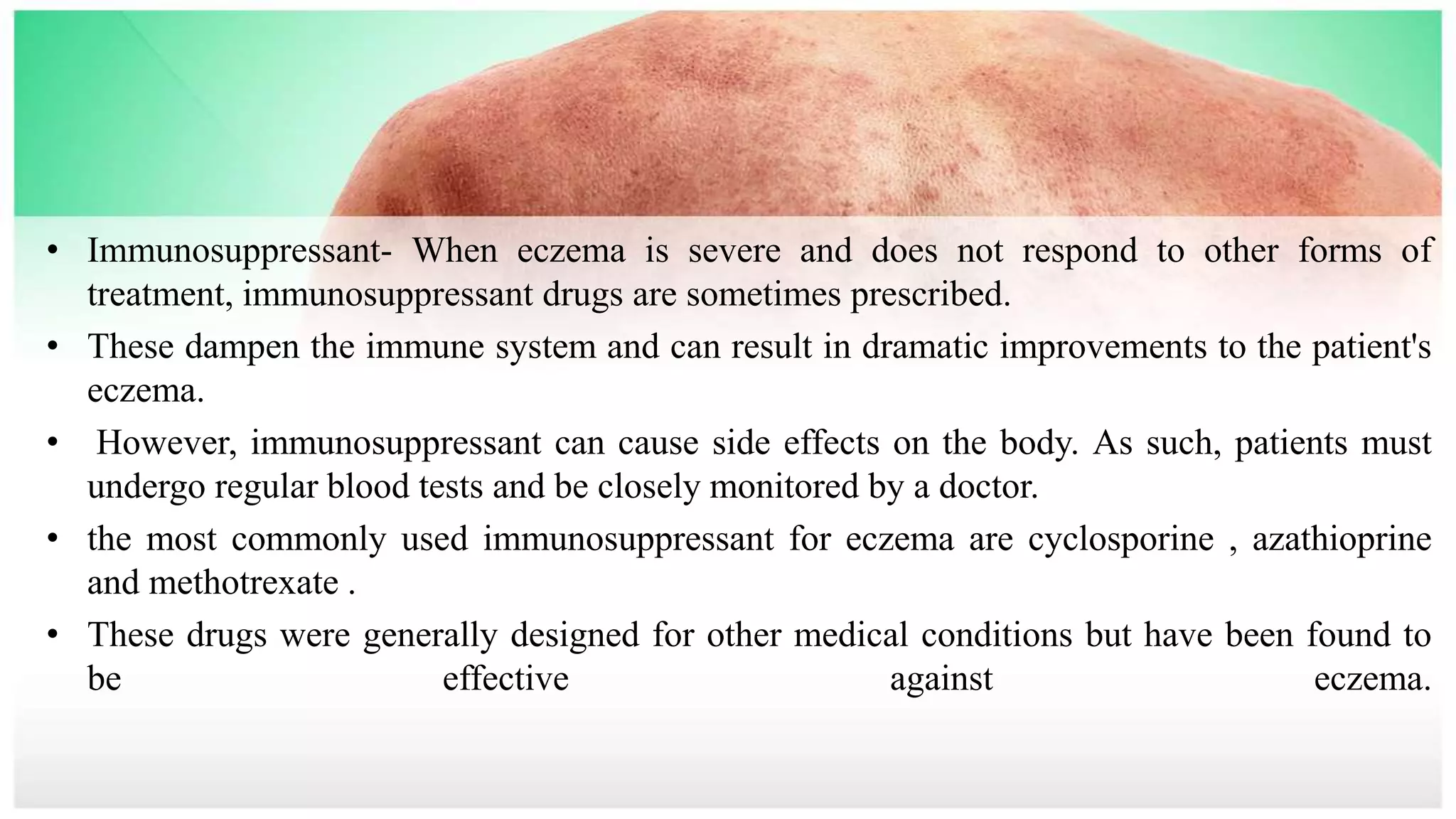ECZEMA.pptx