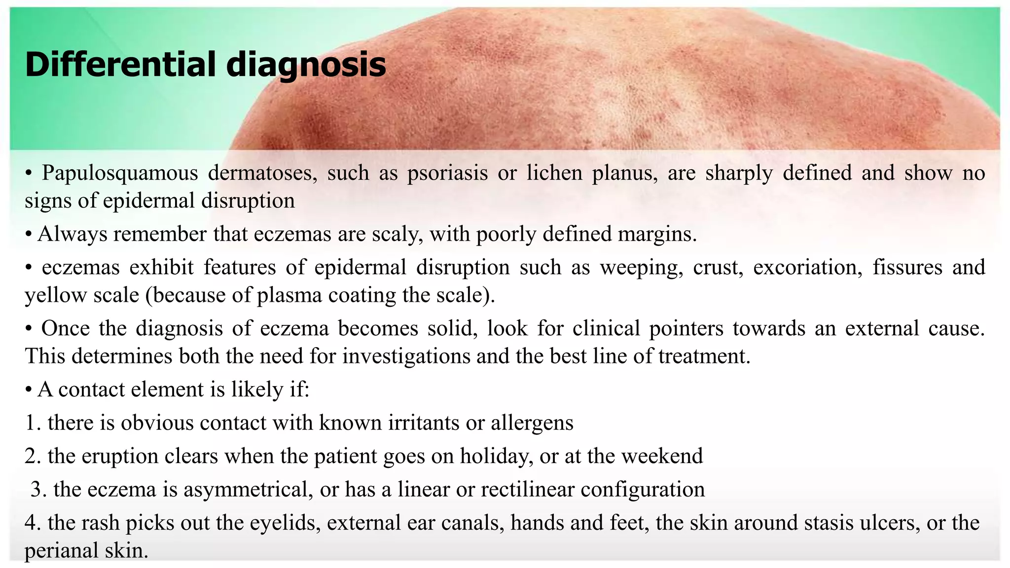 ECZEMA.pptx