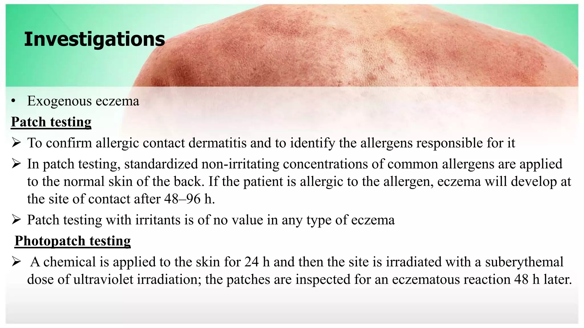 ECZEMA.pptx