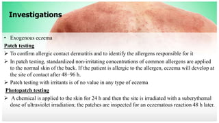 ECZEMA.pptx