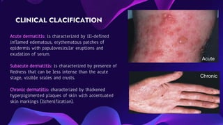Eczema .pptx
