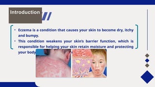 Overview about Eczema and Treatment.pptx