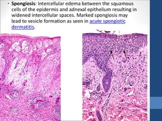 Eczema- case based- Under Graduate. power point | PPT