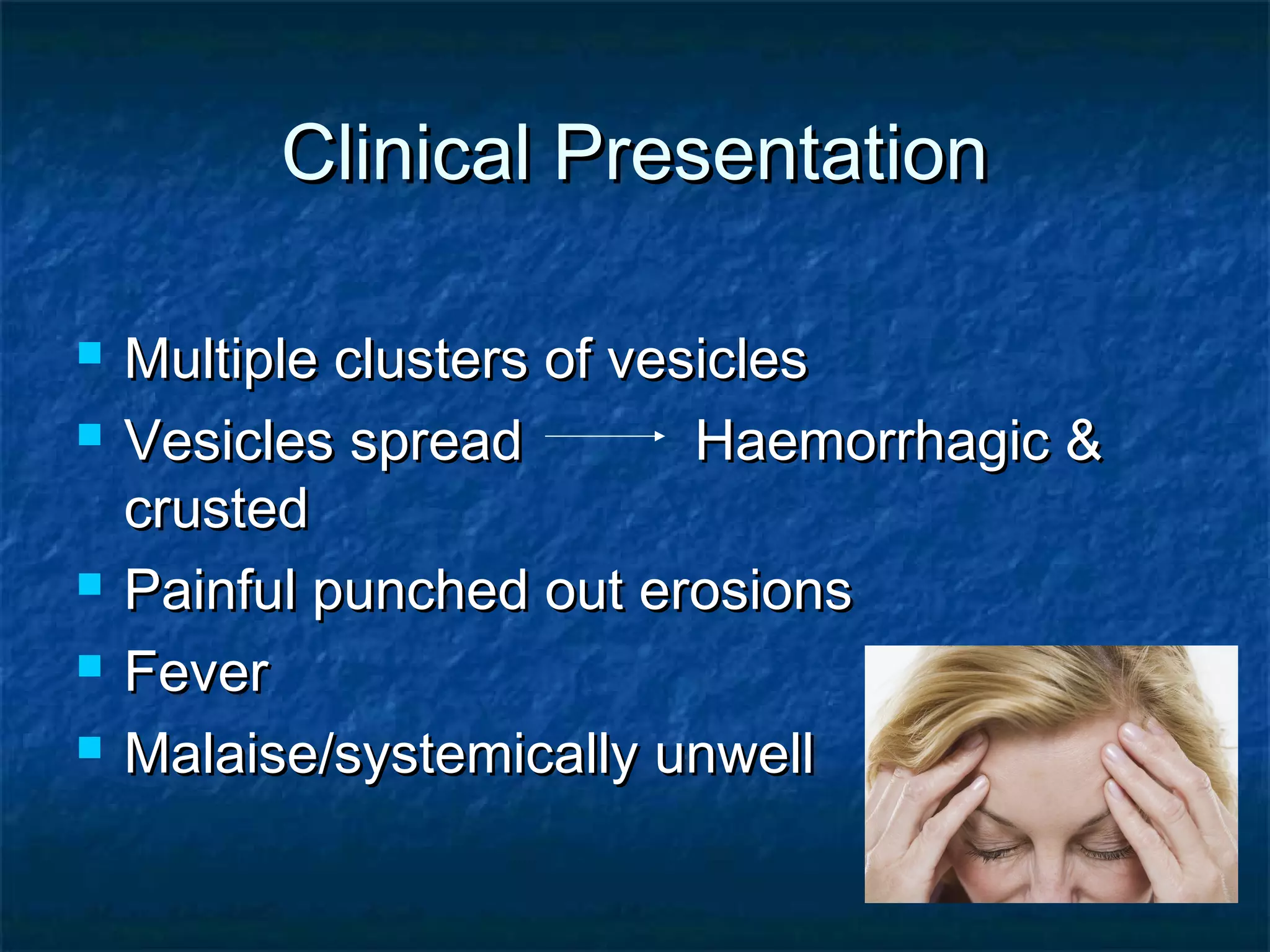 Eczema Herpeticum | PPT