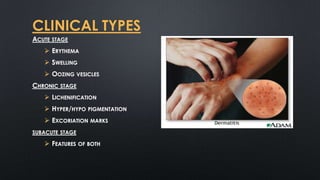 Eczema by sanaullah | PPTX | Skin and Dermatology | Diseases and Conditions