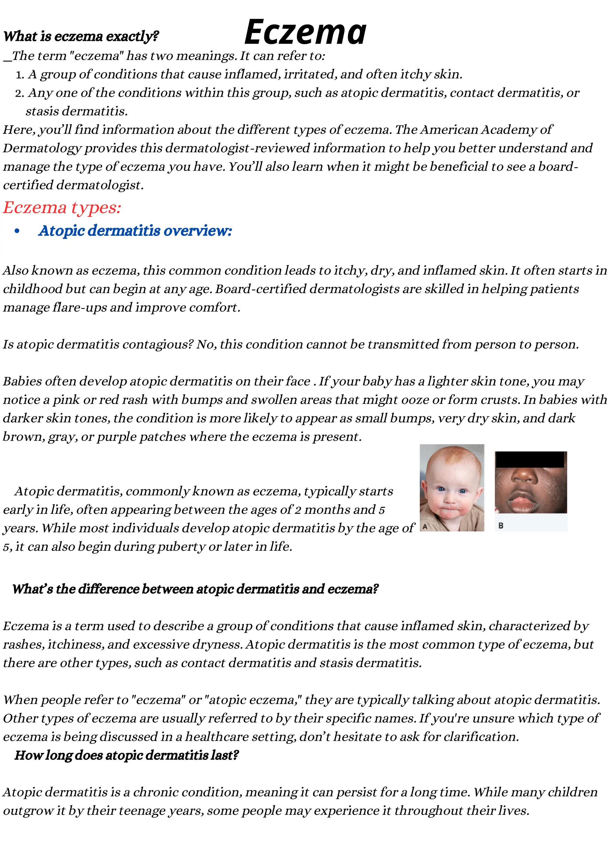 eczema. eczema treatment .eczema for kids | PDF