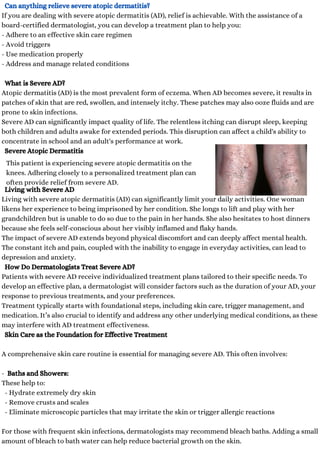 eczema. eczema treatment .eczema for kids | PDF