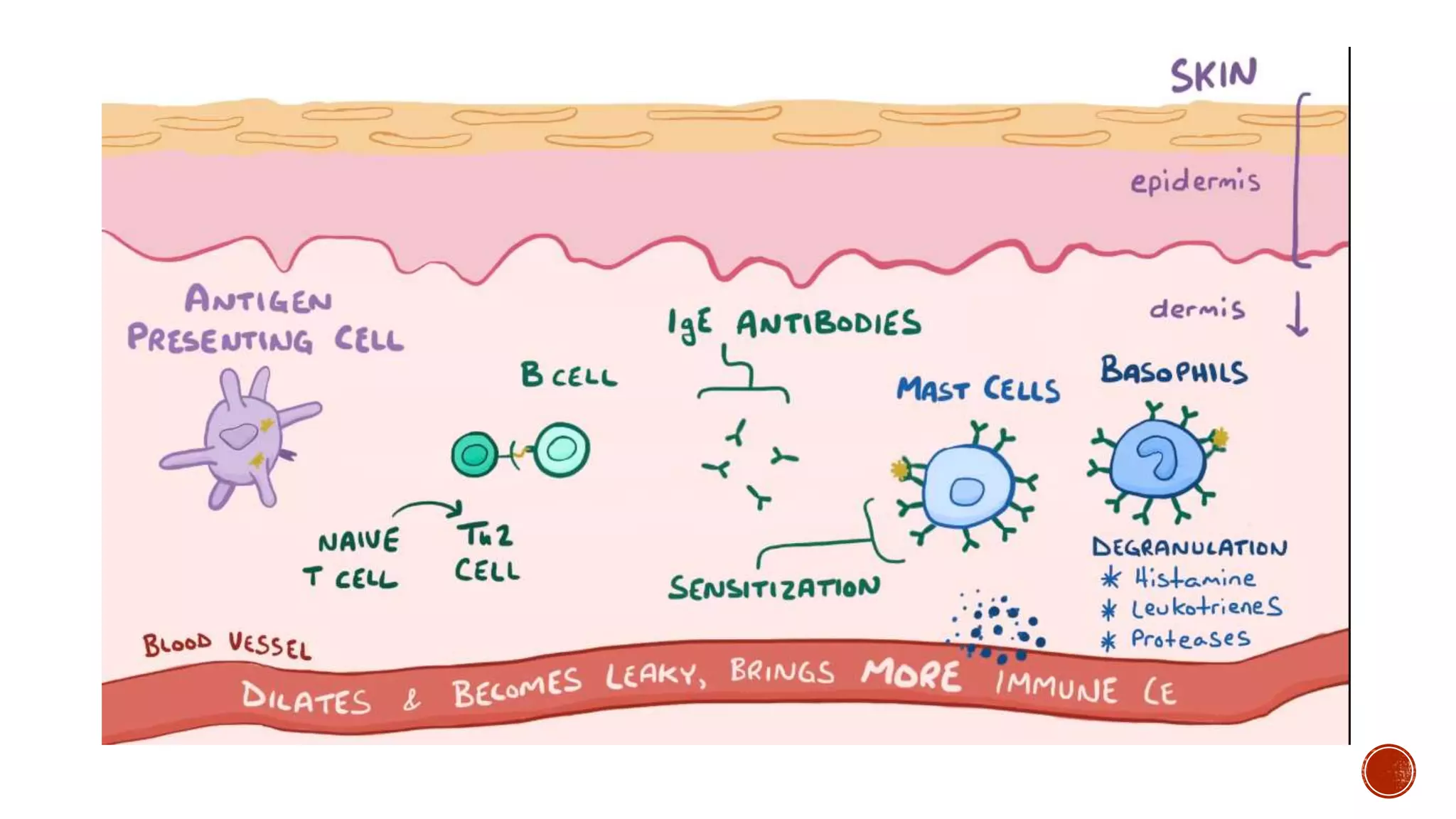Eczema (The Itch that rashes) | PPT